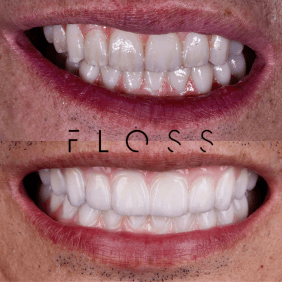Dentist Dallas TX | Floss Dental