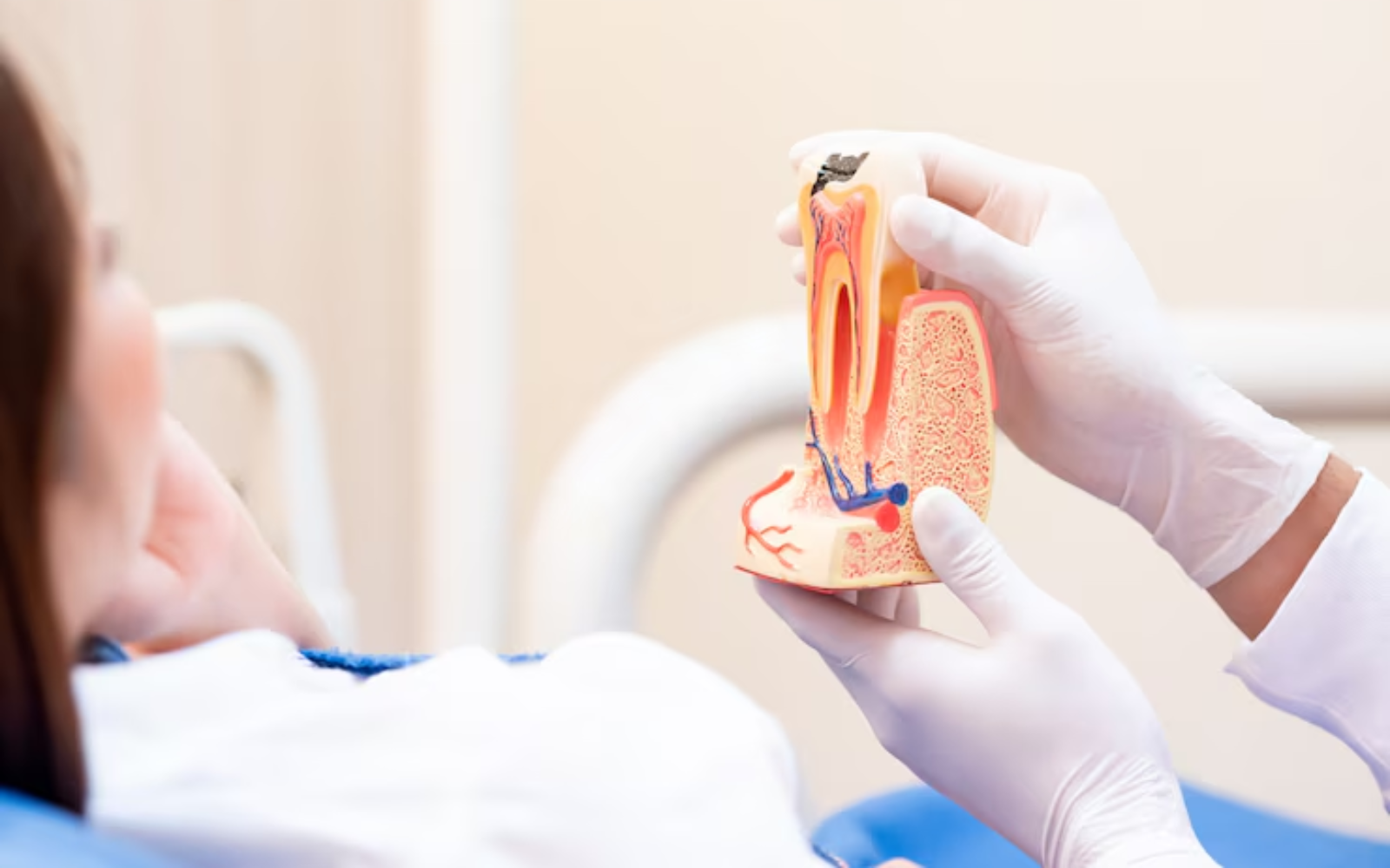 Complete Guide to Caring for Your Teeth After a Root Canal Treatment
